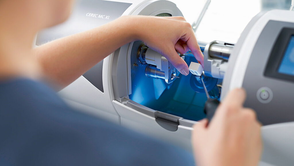 Advantages of the CEREC system (one day service): – Markiewicz Clinic